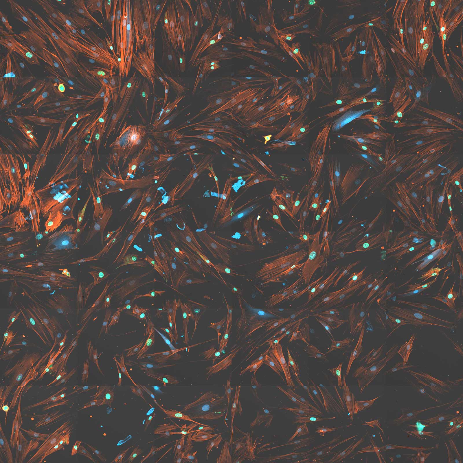 Tissue Repair Slows in Old Age. These Proteins Speed It Back Up | UC ...