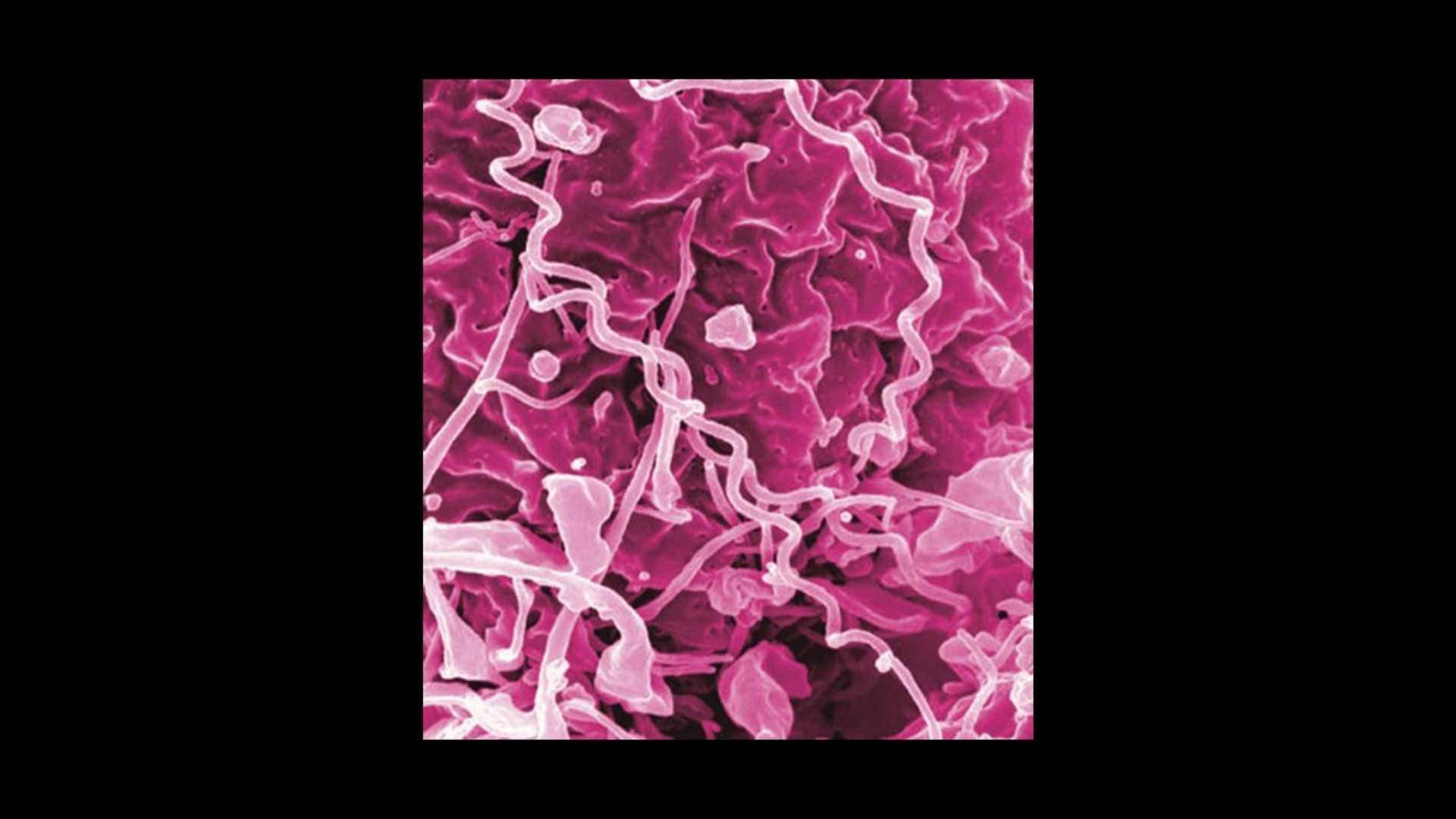 How This Antibiotic Helped STI Cases Drop in San Francisco | UC San ...