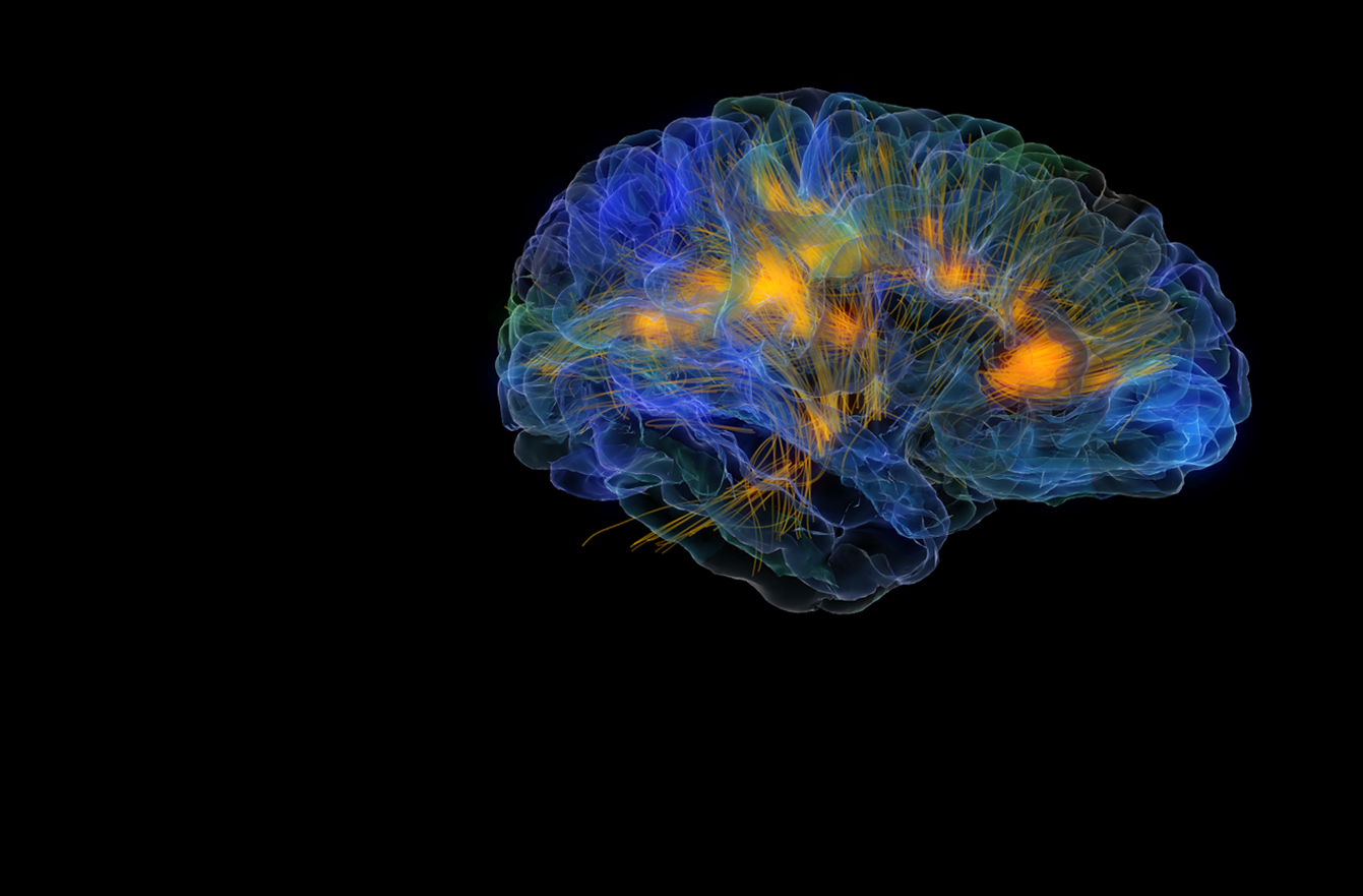 A Beautiful Mind | UC San Francisco