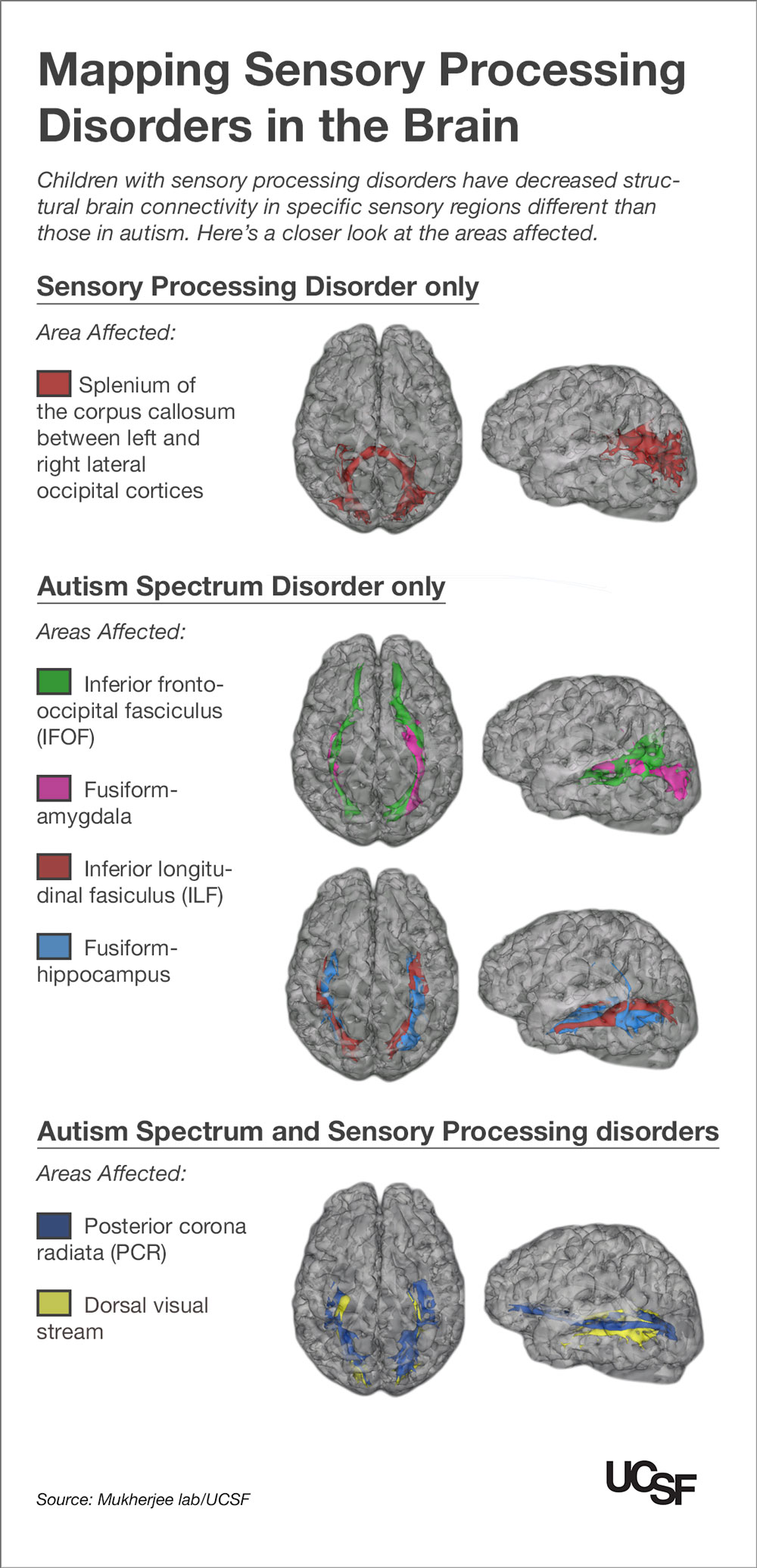 Kids With Autism Sensory Processing Disorders Show Brain Wiring Kids With Autism Sensory Processing Disorders Show Brain Wiring