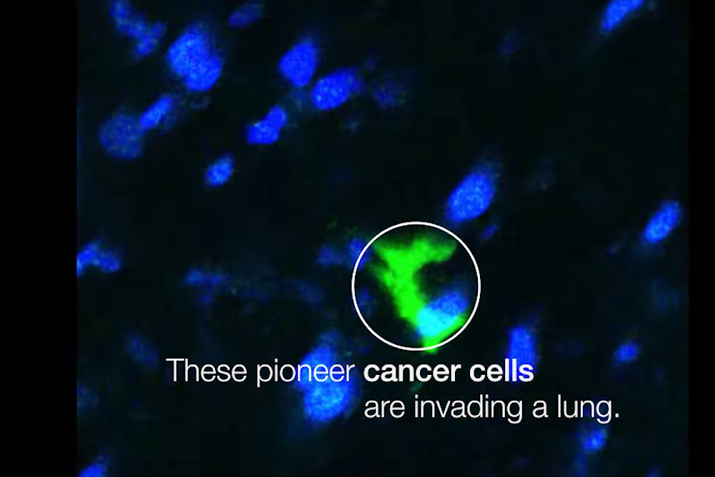 Most Popular Science Stories of 2016 | UC San Francisco