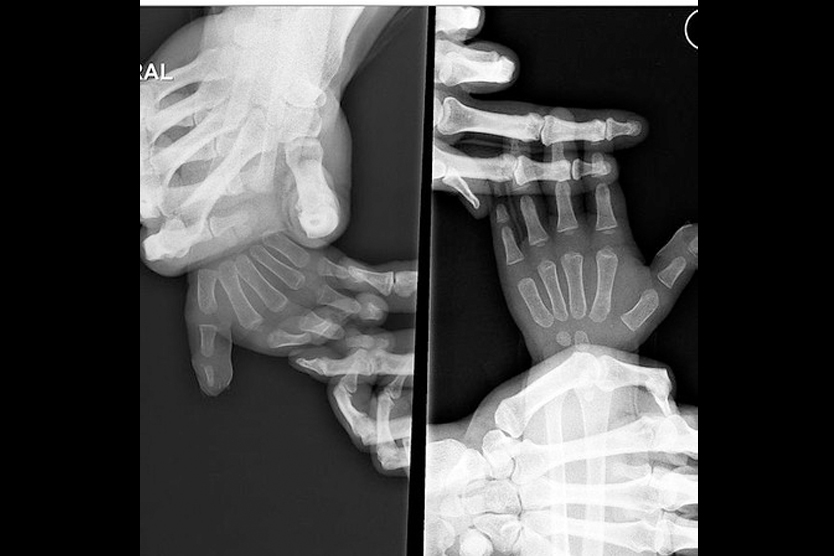 School of Medicine Art Display Focuses on Power of Healing Hands | UC ...