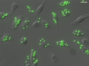 UCSF Report Describes New Model for Neurodegeneration | UC San Francisco