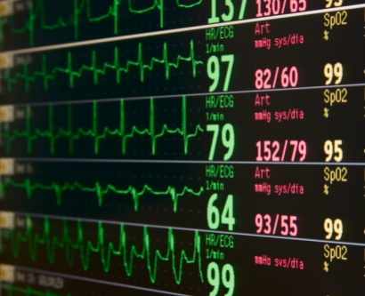 Hospital Logs Staggering 2.5 Million Alarms in Just a Month | UC San ...