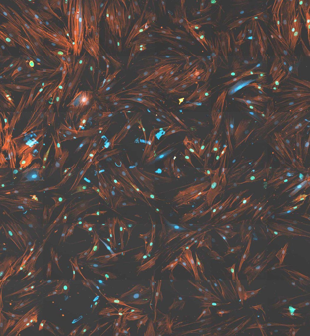 Tissue Repair Slows in Old Age. These Proteins Speed It Back Up | UC ...